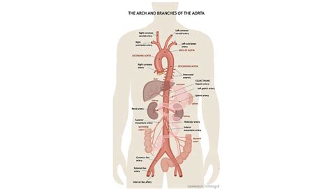 Cpt® 2026 Revises Endovascular Repair Of Thoracic Aorta Coding Aapc