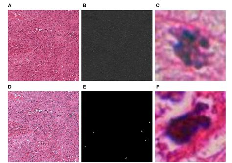 Figure 1 From Deep Learning For Semantic Segmentation Vs Classification In Computational