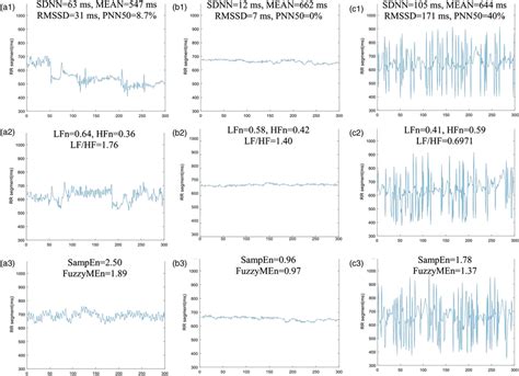 Examples Of Hrv Results From Nyha Functional Class Iii Patient A1a3