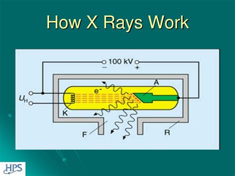 PPT How X Rays Work PowerPoint Presentation Free Download ID