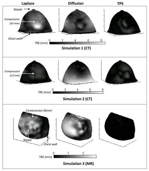 Simulation Registration Error Error When Breast Surfaces Deformed By Download Scientific