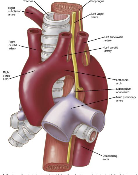Schematic Diagram Showing The Aortic Arch Anatomy The