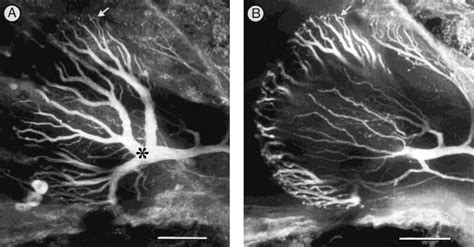 Morphology Of The Lobula Giant Movement Detector Lgmd In The Left