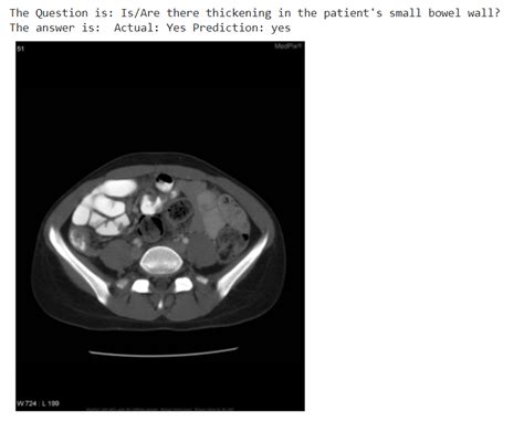 GitHub Bbabina Visual Question Answering Visual Question Answering On Medical Data