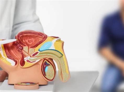 Cómo se hace el examen de próstata en Colombia Tendencias Portafolio