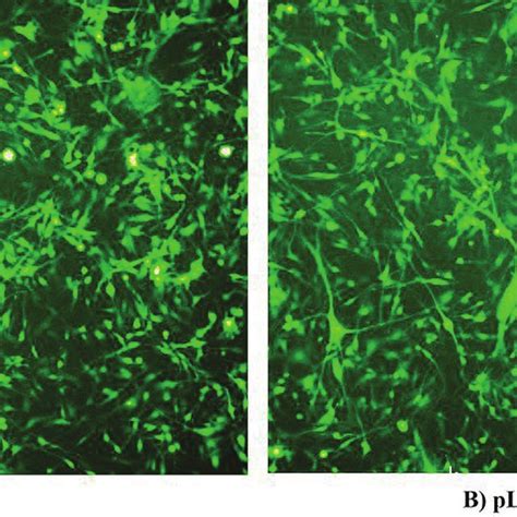 Characterization Of Paclitaxel Albumin Bound Nanoparticles A Download Scientific Diagram