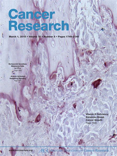Signal Transduction Networks In Cancer Quantitative Parameters Influence Network Topology