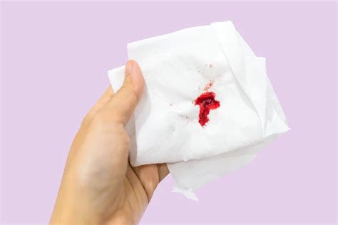 خون ریزی در اولین رابطه زناشویی؛ تمام آنچه که دختران باید بدانند هرلایف