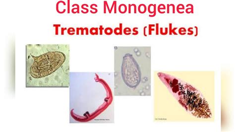Phylum Platyhelminthes Class Monogenea Class Trematoda Youtube
