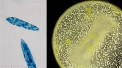 Anabaena Under Microscope Biology Notes Online