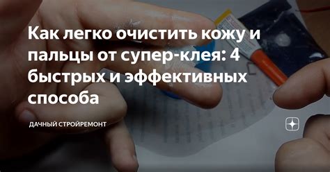 Как легко очистить кожу и пальцы от супер клея 4 быстрых и эффективных способа Дачный