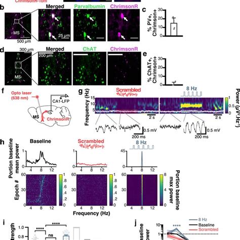 Grin Lens Implant Does Not Affect Theta Oscillations And Enables Download Scientific Diagram