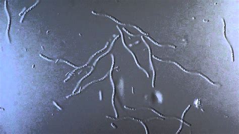 Spirilla Bacteria Under Microscope