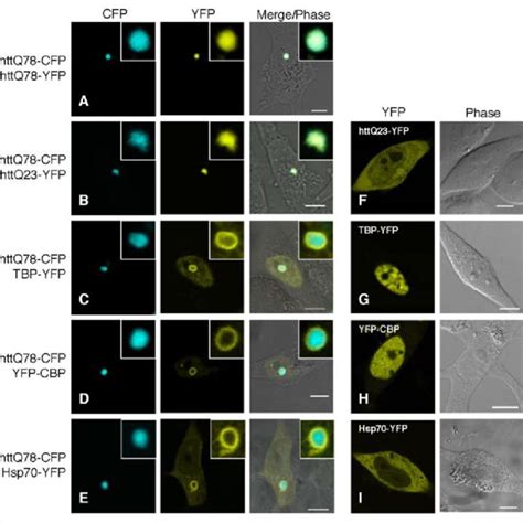 Pdf Huntingtin And Mutant Sod1 Form Aggregate Structures With