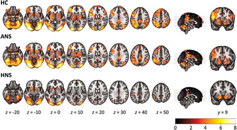 Mean Activation Maps For Positive Correlation With Rpe In The Healthy