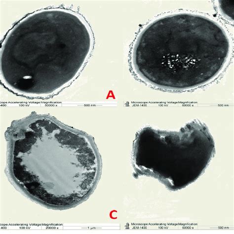 A D Transmission Electron Micrograph Tem Of Cryptococcus Download Scientific Diagram
