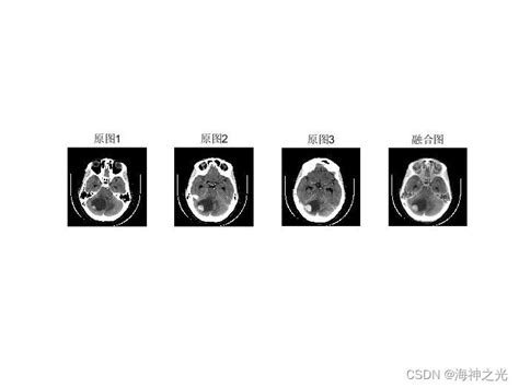 【图像融合】基于matlab主成分结合小波离散变换pca Dwt三张图像融合【含matlab源码 2199期】dwt图像融合 Csdn博客