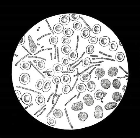 Anthrax Disease Illustrations Royalty Free Vector Graphics And Clip Art Istock