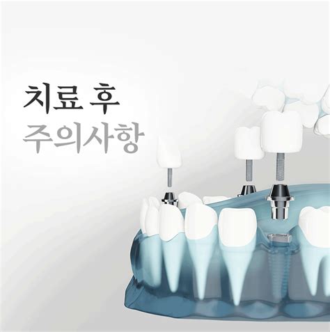 진료 주의사항 1 페이지 수원화이트드림치과 수원치과 수원임플란트 수원치아교정 수원교정치과 인계동치과
