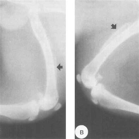 Radiographic Evaluation Of Ectopic Bone Formation Download Scientific Diagram