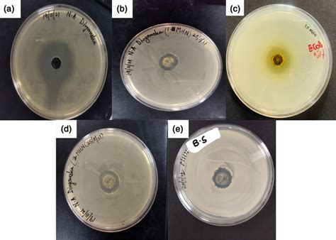 Disc Diffusion Test Images Showing Inhibition Zone Formation Through Download Scientific