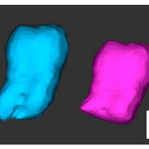 a b segmentation of the tooth transplant blue c segmented donor