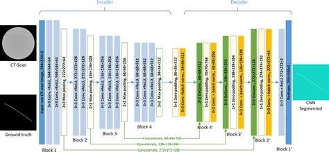 Architecture Of The Implemented Vgg U Net Composed Of Encoder And