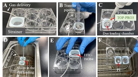 Video Author Spotlight Imaging Pericytes Post Subarachnoid