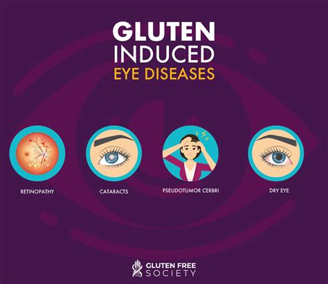 Celiac Eyes