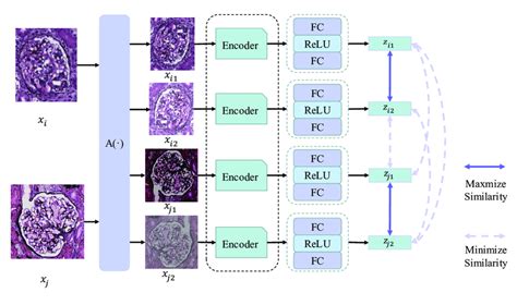 The Overview Of Contrastive Learning The Purpose Of Contrast Learning Download Scientific