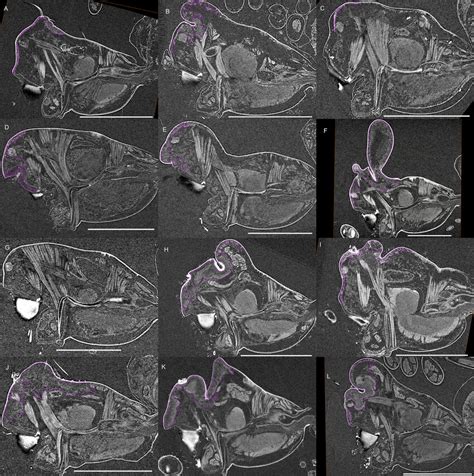 Virtual Slices Of Micro Ct Scans On The Sagittal Plane With Gustatory