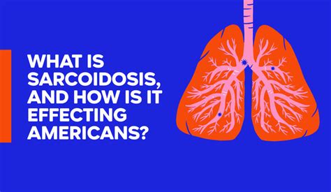 What Is Sarcoidosis And How Does It Effect Americans Direct Primary