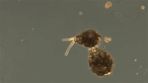 Light Microscope Footage Of Difflugia Pyriformis Testate Amoeba Showing Their Movement In