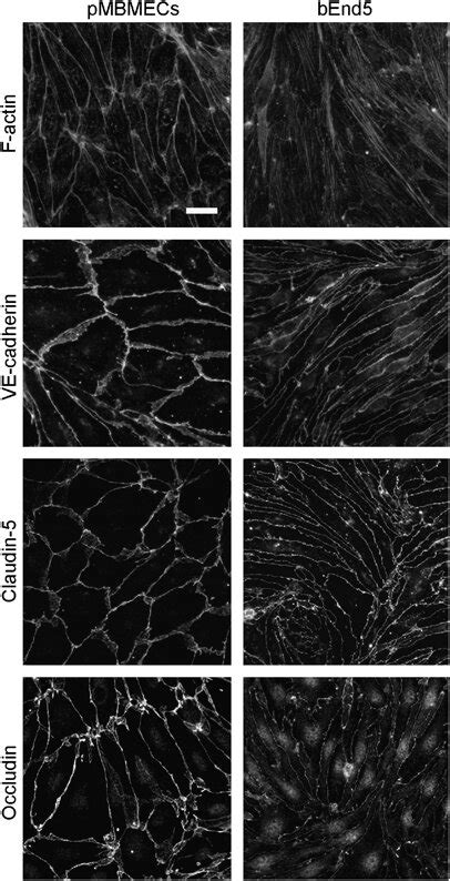 Differences In Junctional Protein Expression And F Actin Cytoskeleton Download Scientific