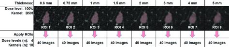 Segmentation Procedure For Lung Nodules Each Nodule Was Segmented From Download Scientific
