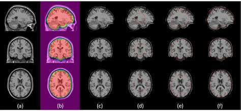 Figure 1 From Title Knowledge Guided Robust Mri Brain Extraction For Diverse Large Scale
