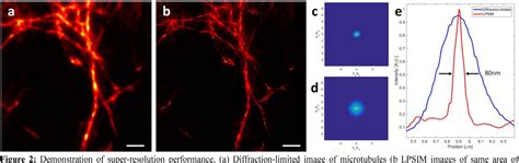 Figure 2 From High Speed Super Resolution Microscopy For Biological Imaging Semantic Scholar