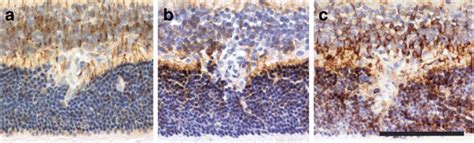 Histological Characterization Of Aqp4 Loss In The Outer Plexiform Download Scientific Diagram