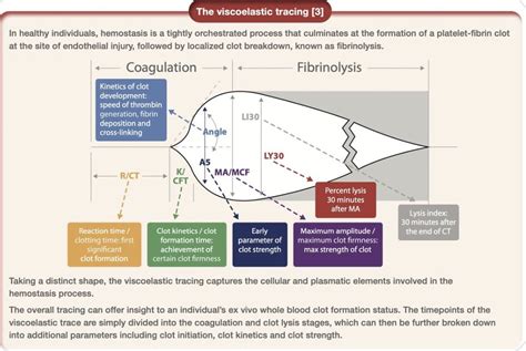 The Heart 🔴 Viscoelastic Testing An Illustrated Review Of Technology And Clinical