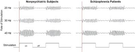Figure 1 From Classification Of Schizophrenia Using Genetic Algorithm Support Vector Machine Ga
