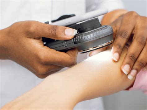 أمراض الجلد Healthy Horizons