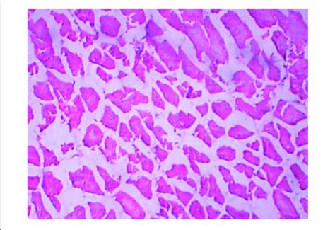Treated Muscle Section Showing Splitting Fiber And Variation In Download Scientific Diagram