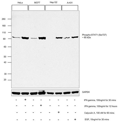 Phospho Stat1 Ser727 Recombinant Monoclonal Antibody 2h10 Ma5 33198