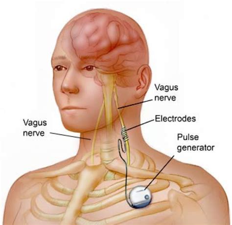 Neuro Exam 2 Ppt Flashcards Quizlet