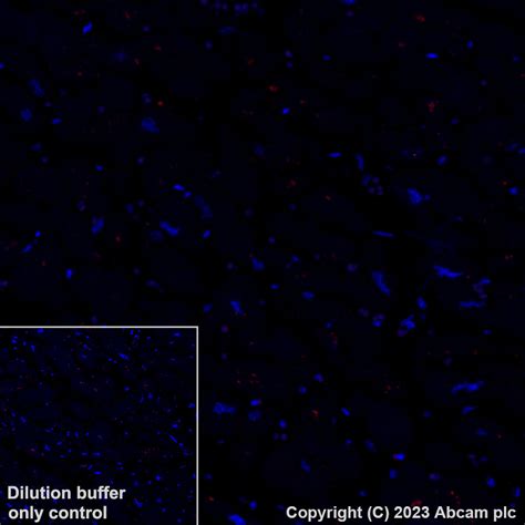 Alexa Fluor® 647 Anti Hla Class 1 Abc Antibody Epr22172 Ab315134 Abcam