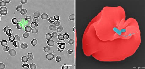 Human Erythrocytes Infected With B Bacilliformis Left Fluorescence