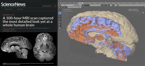 Converting Video If A Brain Mri Scan To A Mesh In Blender Blendernation