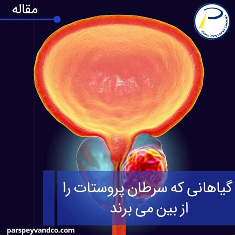 گیاهانی که سرطان پروستات را از بین میبرند