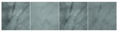 Examples Of Low Resolution Partial Palmprints Typically Used In Online Download Scientific