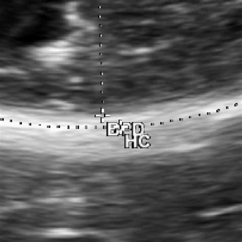 Pdf An Automated Framework For Image Classification And Segmentation Of Fetal Ultrasound
